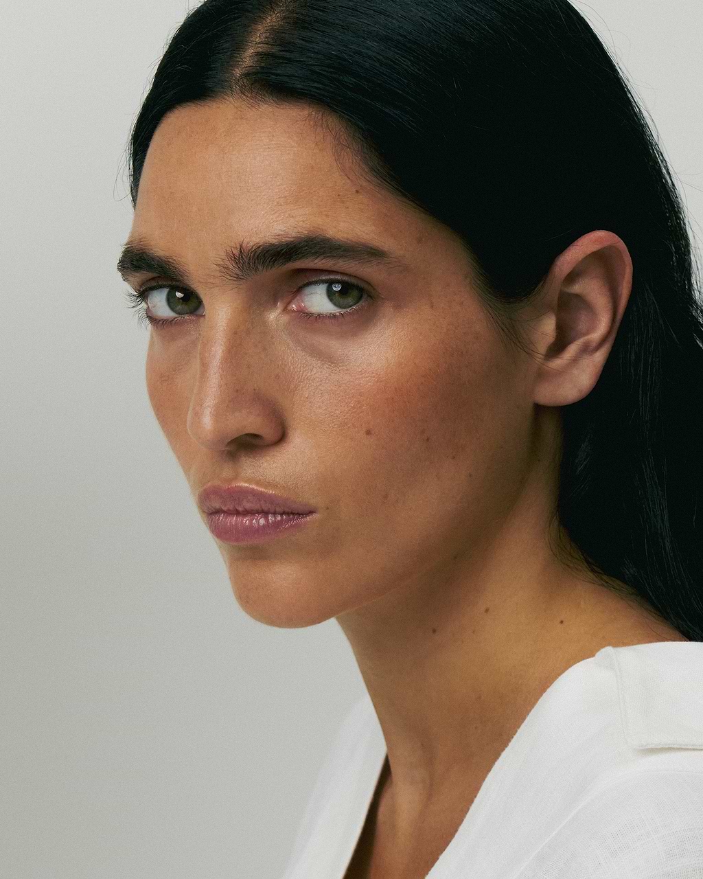 Lupus et boutons : quels mécanismes expliquent leur appariti — Typology